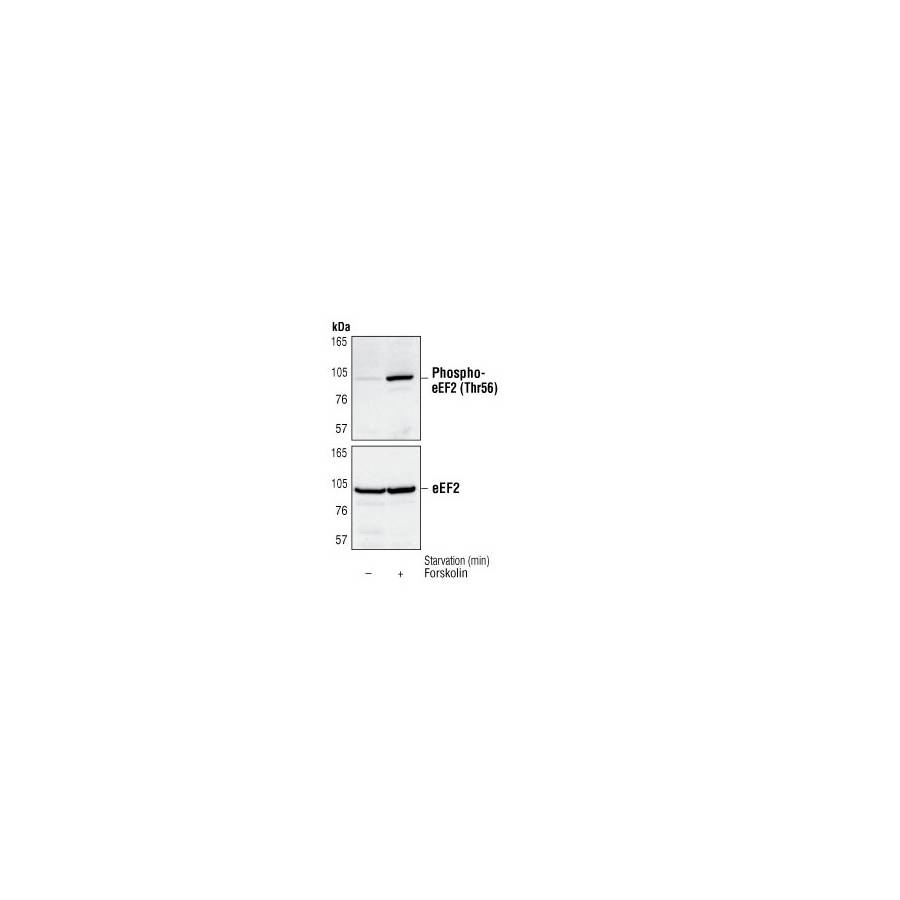 Fragile X/FMRP Signaling Pathway Antibody Sampler Kit