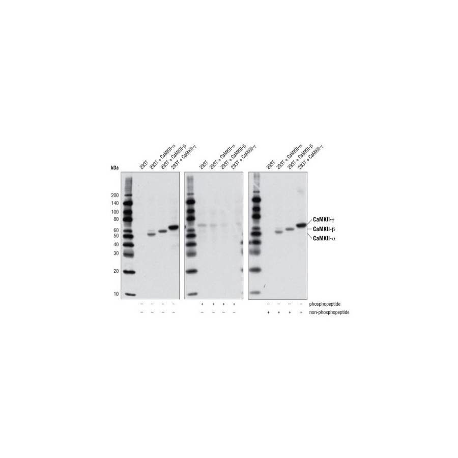 Phospho-CaMKII (Thr286) (D21E4) Rabbit mAb