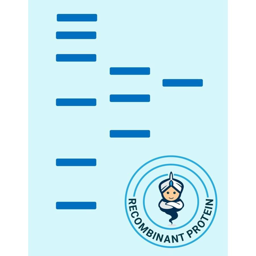 Human CCL3L1 Recombinant Protein (RPPB1110) - OZYME - Ozyme