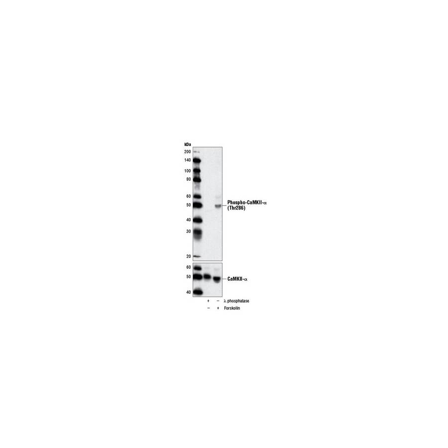 Phospho-CaMKII (Thr286) (D21E4) Rabbit mAb