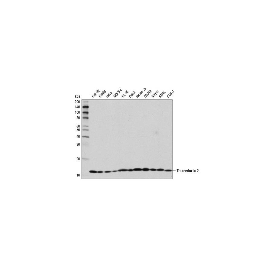 Redox Homeostasis and Signaling Antibody Sampler Kit
