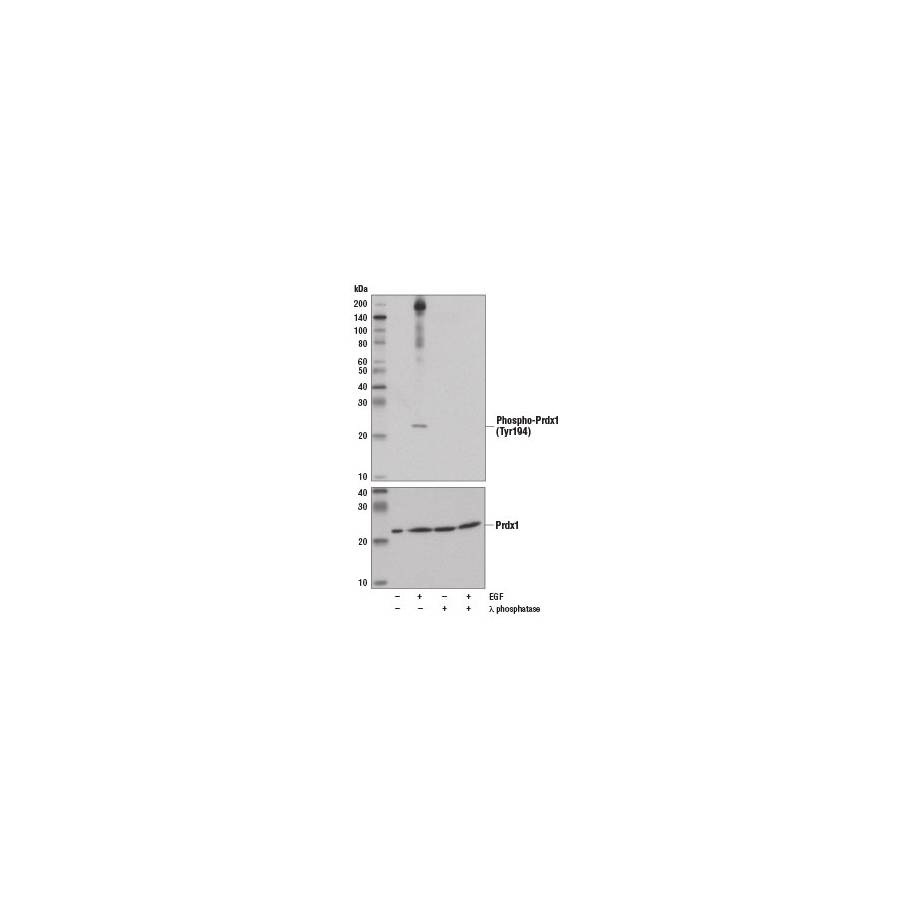 Redox Homeostasis and Signaling Antibody Sampler Kit